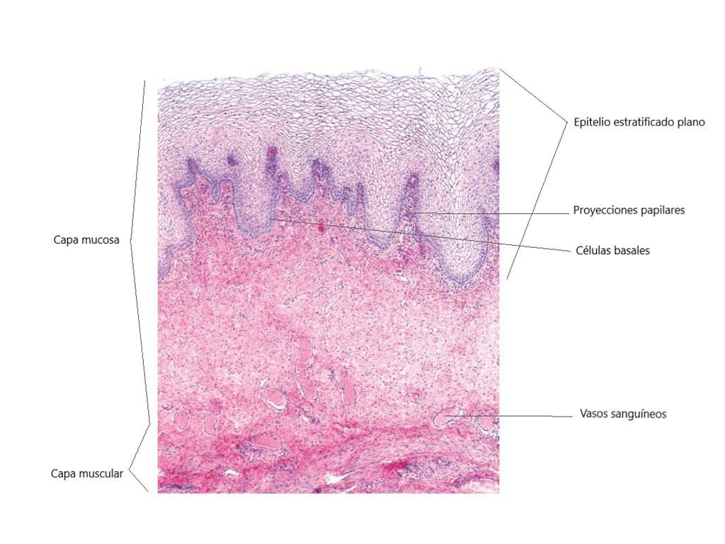 Cambios histológicos en el tejido vulvar luego del tratamiento con ...